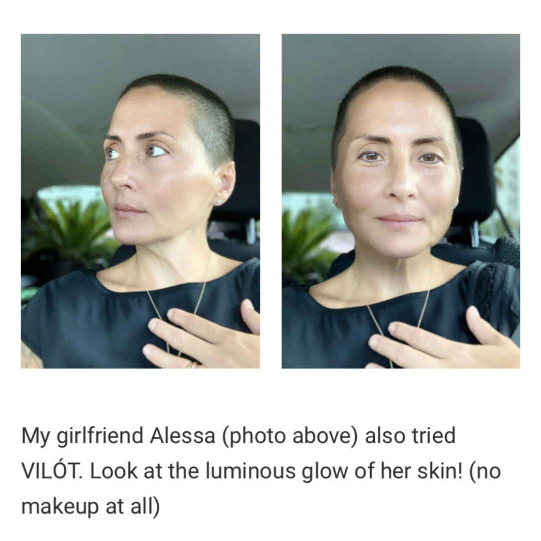 Anti Aging Multi-Balm stick for Moisture, Hydration, Skin Rejuvenation ...